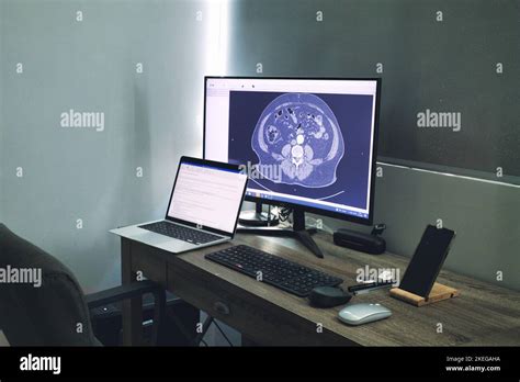 Working On Ct Scan On A Cardiovascular Disease To Do Segmentation Of