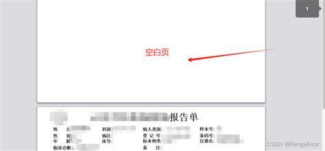 解决printjs打印图片时多出一张空白页的问题print Js 多显示了空白页 Csdn博客