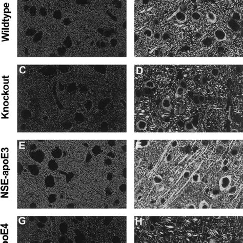 Neuronal Labeling For Apoe In Nse Apoe Mice And A Human Ad Case