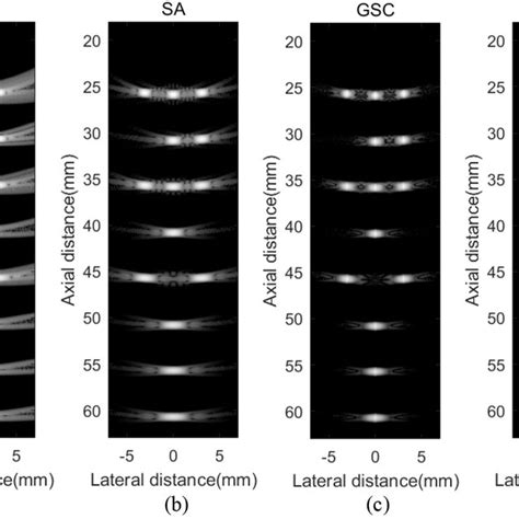 Simulated Circular Cyst Target Images With Different Algorithms A Download Scientific