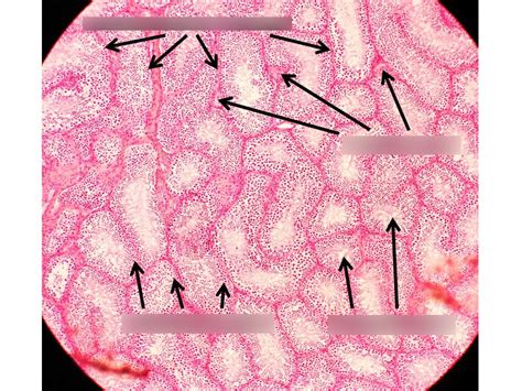 Microscope Of Testis Diagram Quizlet