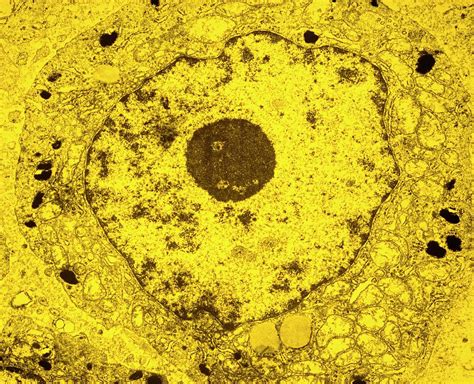 Fcol Tem Of Malignant Melanocyte From Melanoma Photograph By Science