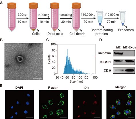 Bioactive Materials 上海大学转化医学研究院苏佳灿M2型巨噬细胞来源外泌体通过免疫调节促进糖尿病骨折愈合 外泌体资讯网