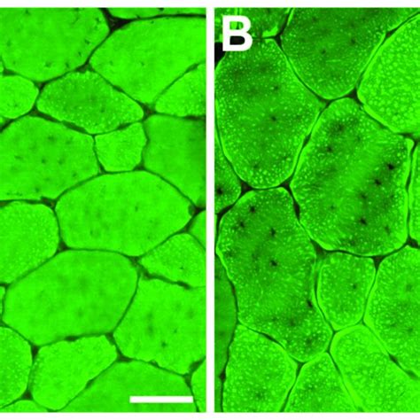 Bodipy Staining For Intramyocellular Lipids Within The Tibialis