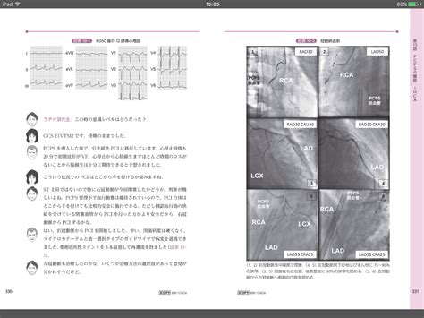 電子書籍版｜明日のアクションが変わる 補助循環の極意 教えます M2plus