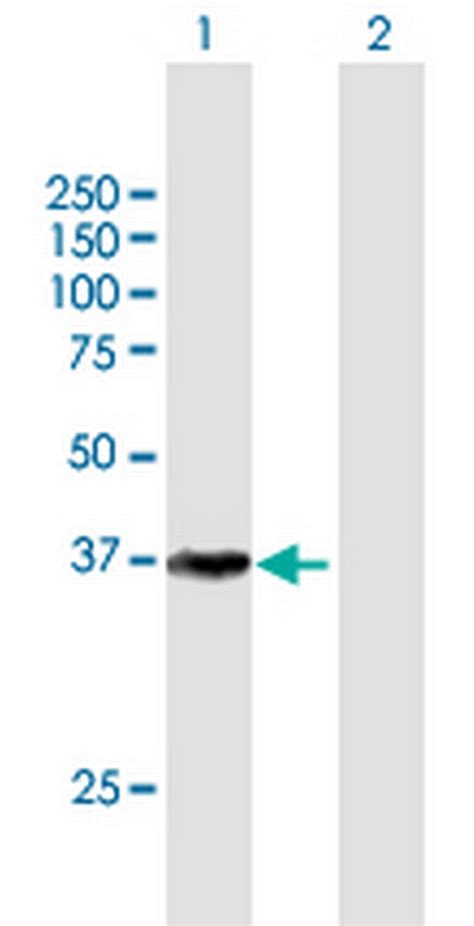 Cdk7 Polyclonal Antibody H00001022 B01p