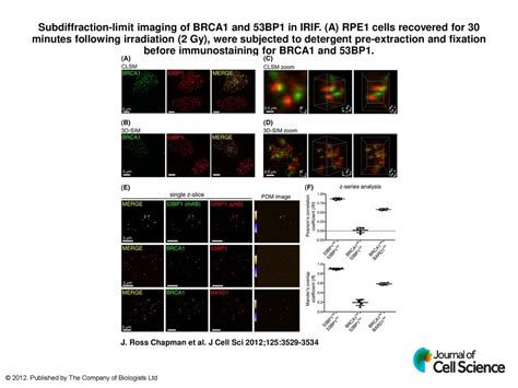 Subdiffraction Limit Imaging Of Brca1 And 53bp1 In Irif Ppt Download
