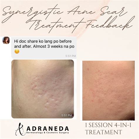 Adraneda Dermatology And Cosmetic Surgery Home