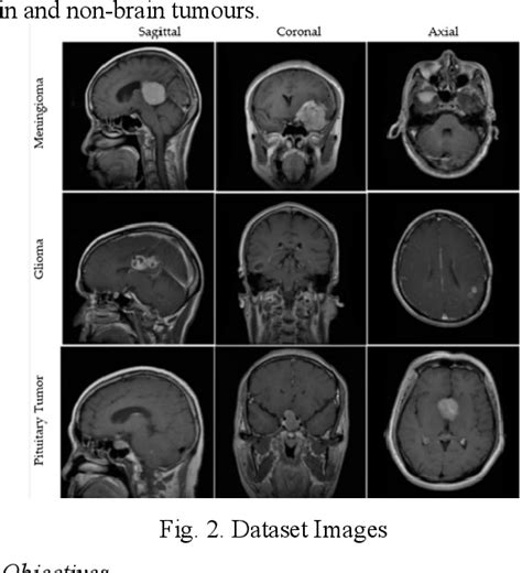 Figure 2 From Fine Tuning Based Deep Transfer Learning System Used To