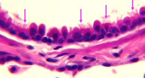 Structures Lecture 17 18 Lungs Flashcards Quizlet