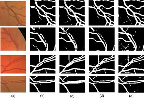 Segmentation Results On Some Selective Regions Showing The Improvements