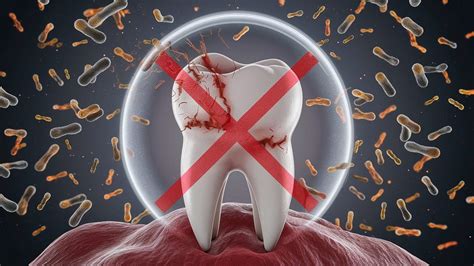 Can Probiotics Get Rid Of A Tooth Infection Exploring The Potential