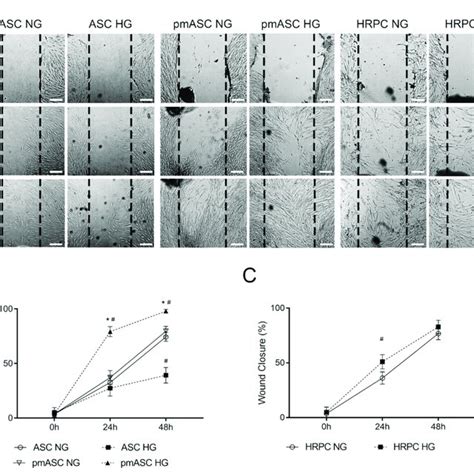Cell Migration Ability Evaluated By Wound Healing Assays In Human