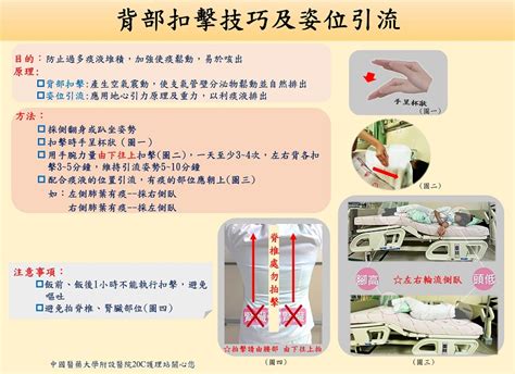 背部扣擊技巧及姿位引流 衛教海報 中國醫藥大學附設醫院