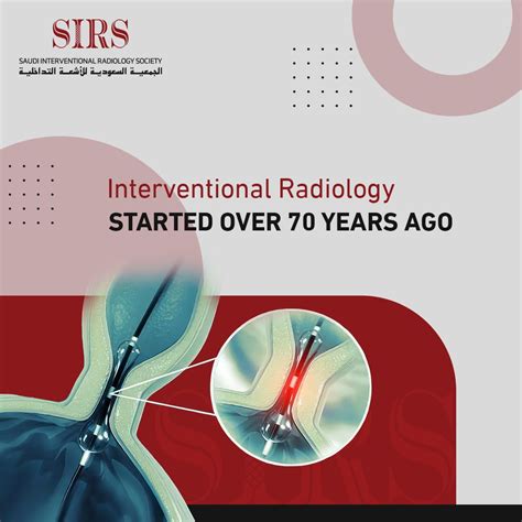 Sirs Interventional Radiology Saudi Interventional Radiology Society