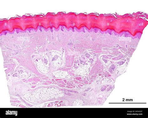 Low Power Light Microscope Micrograph Of Human Glabrous Skin From Top The Epidermis A