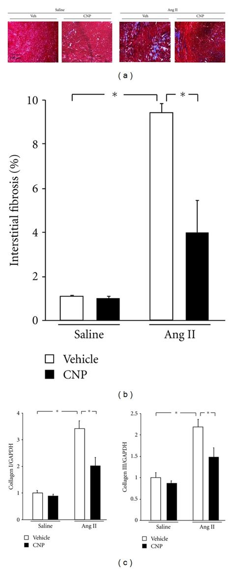 Effects Of Cnp On Ang Ii Induced Myocardial Interstitial Fibrosis A