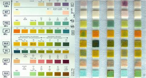 Urine Strip Urinalysis Test Strip Color Chart Learnparallaxcom