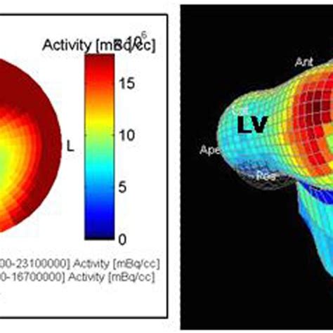 Pictures Obtained From A 67 Year Old Man With Ph Of Mixed Origin Copd