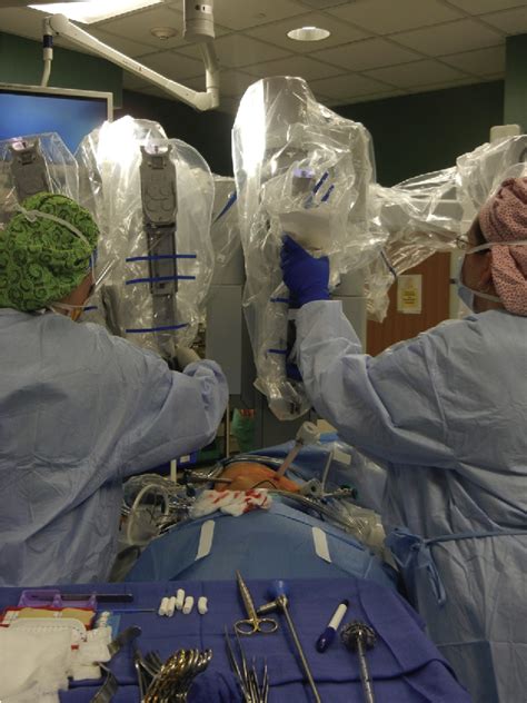 Electromagnetic Navigational Bronchoscopy And Robotic Assisted Thoracic Surgery Semantic Scholar