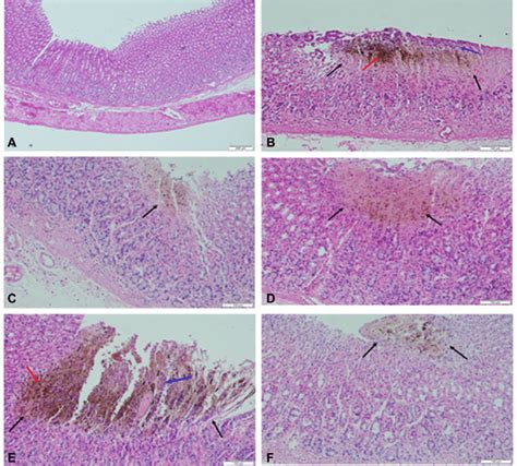 A The Control Group Show Normal Gastric Histopathology Hande ×100 B