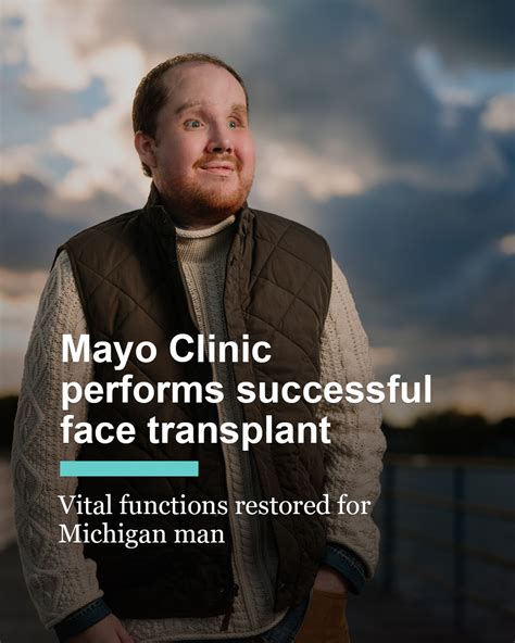 A Michigan Man Can Blink Swallow Smile And Breathe Through His Nose