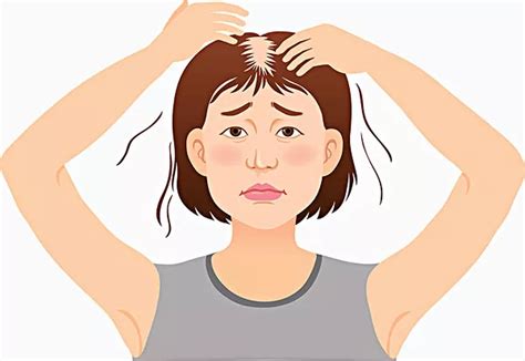 【科大毛发】女性脱发危机：专家揪出5大脱发原因