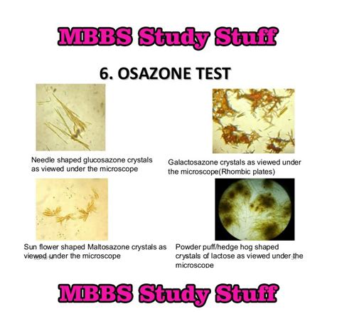 Osazone Test Medical Study Zone