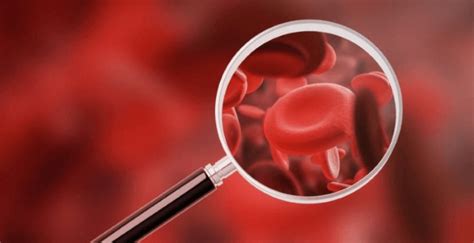 Eritrosit Rbc Nedir Eritrosit Yüksekliği Ve Düşüklüğü Obezite Haber