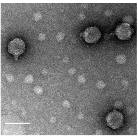 Transmission Electron Micrograph Of Jc1 High Titer Cscl Gradient