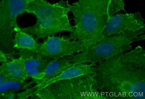 Cd146 Mcam Antibody Cl488 17564 Proteintech