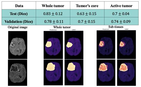 GitHub RoyHirsch BrainTumorSegmentation Final Bsc Project Using NN