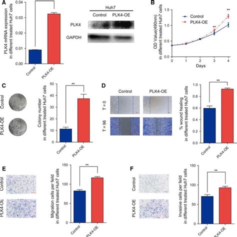 Overexpression Of Plk4 Promotes Hcc Cell Proliferation And Migration