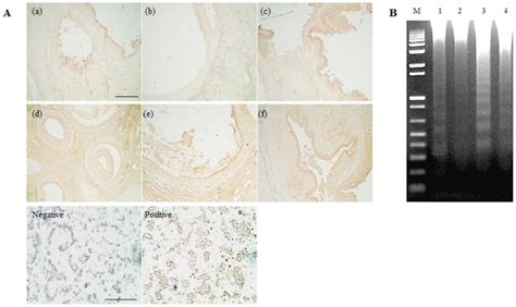 Apoptosis Detection Analyses Used Terminal Deoxynucleotidyl Transferase