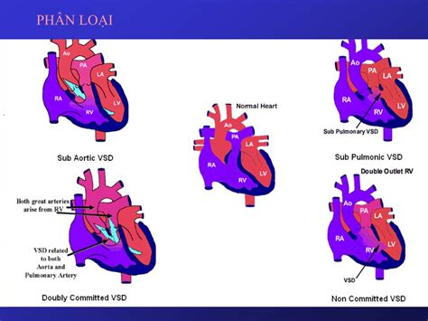 Ppt Th T Ph I Hai Ng Ra Powerpoint Presentation Free Download Id