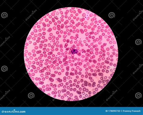 Staphylococcus Saprophyticus Sample Culture Microbiology Royalty