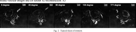 Figure 2 From 3D Rotation Scan Of Rat Retinal Vessels Using 30MHz