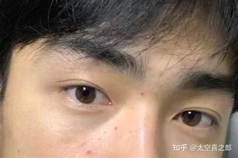 有什么办法可以快速淡化黑眼圈啊本人男真的快要被黑眼圈逼疯了急需淡化很眼圈细纹泡泡眼贼牛的眼霜 知乎