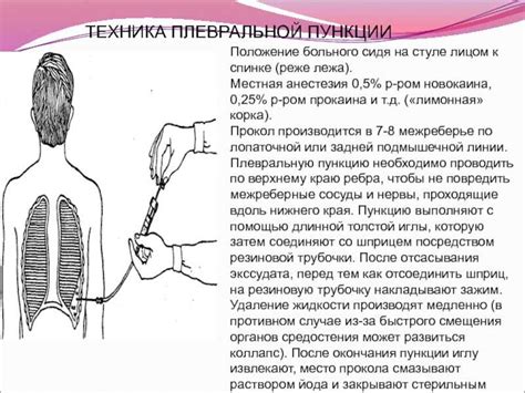 Плевральная пункция: что это, показания и противопоказания, подготовка