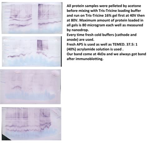 16 Tris Tricine Gel Recipe