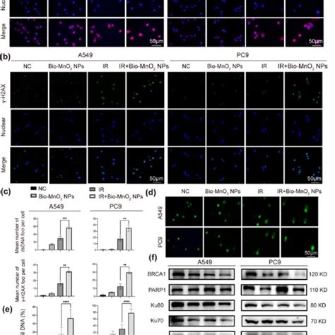 Bio Mno2 Nps Plus Radiation Increased Dna Damage In Nsclc Cells A