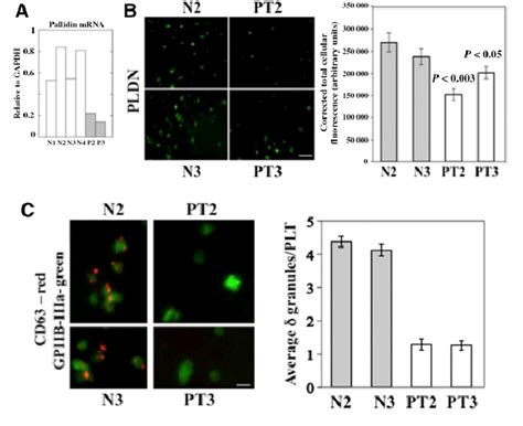 Pallidin Pldn Expression And Cd63 Positive Dense Granules In