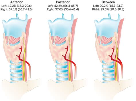 Recurrent Laryngeal Nerve And Inferior Thyroid Artery A Rare