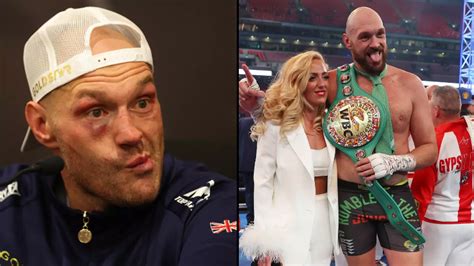 Tyson Fury Shared Big Regret In Life After Admitting Hed ‘lost Count