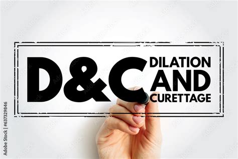 D And C Dilation And Curettage Is A Procedure To Remove Tissue From Inside Your Uterus