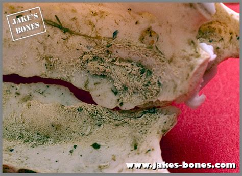 Strange Bones 14 Two Weird Bone Pathologies Jake S Bones