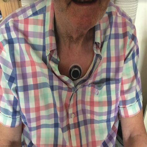 The Novel Vibrotactile Stimulation Device Cue1 Charco Neurotech Ltd