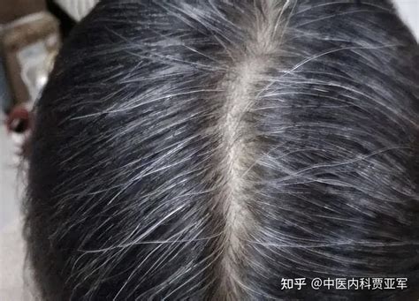先天不足后天补，肾精不足调脾胃！教你1招，脾肾双补，搞定肾虚 知乎