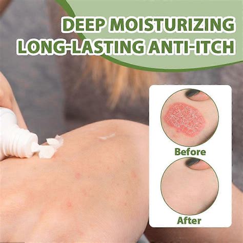 Sumifun Tea Tree Oil Eczema Anti Itch Ointment Efficacy On Skin Anti Itching Emulsifiable Paste