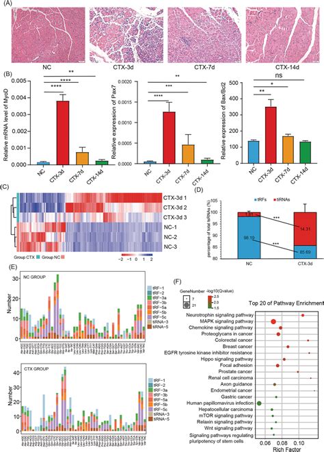 The TsRNAs Expression Profile In The Initial Stage Of Muscle Injury